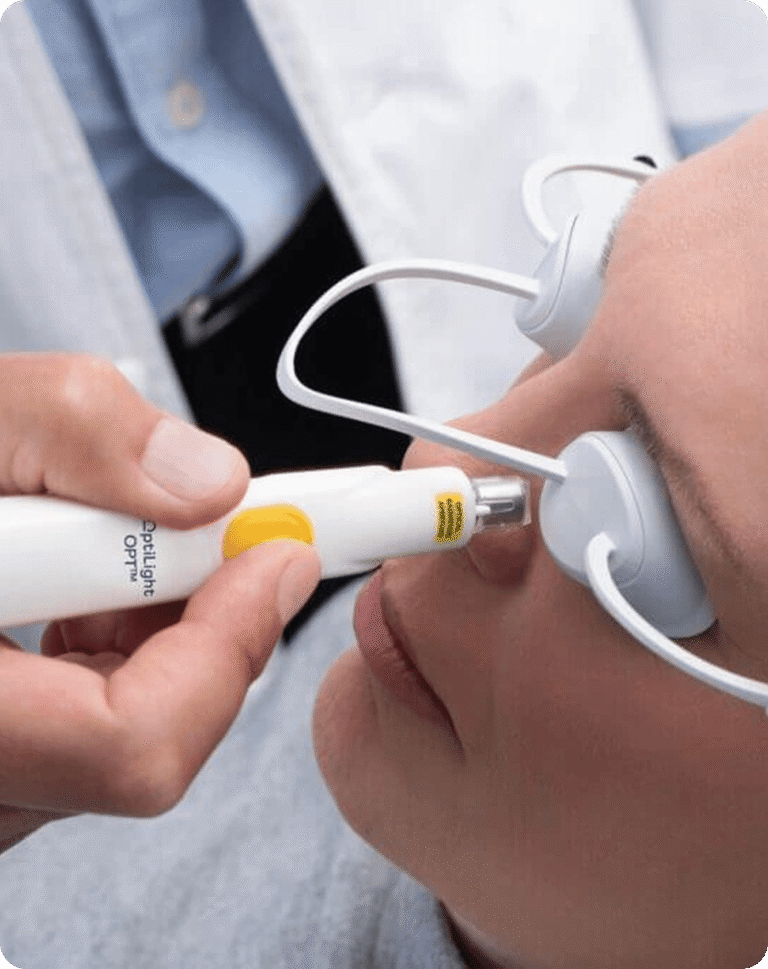 IPL Eye Treatment Plano